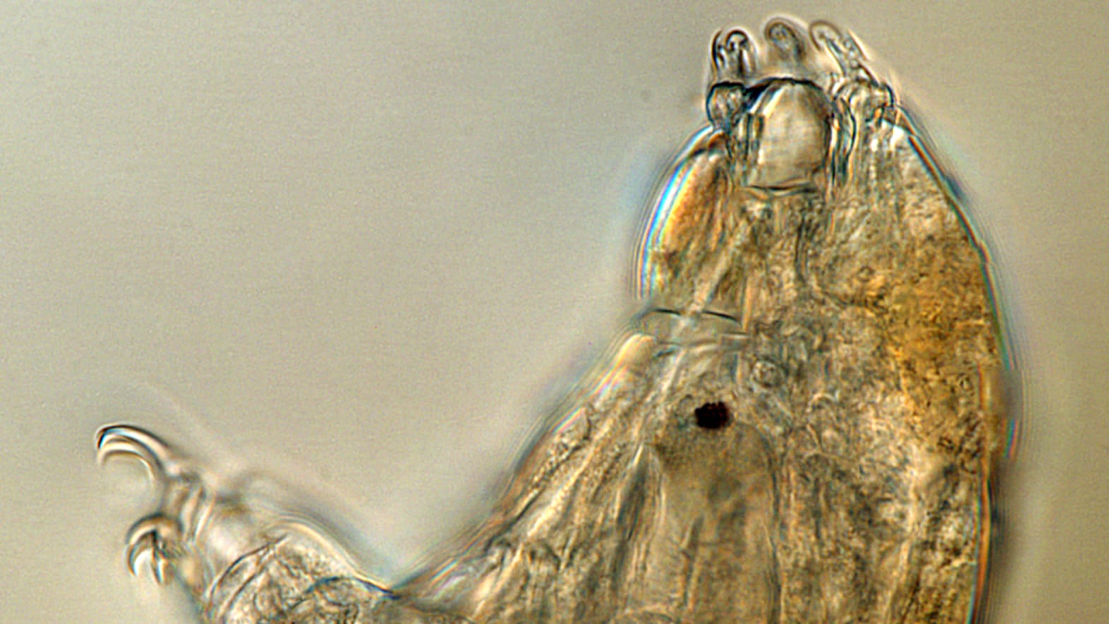 Science Says: Tiny 'Water Bears' Can Teach Us About Survival