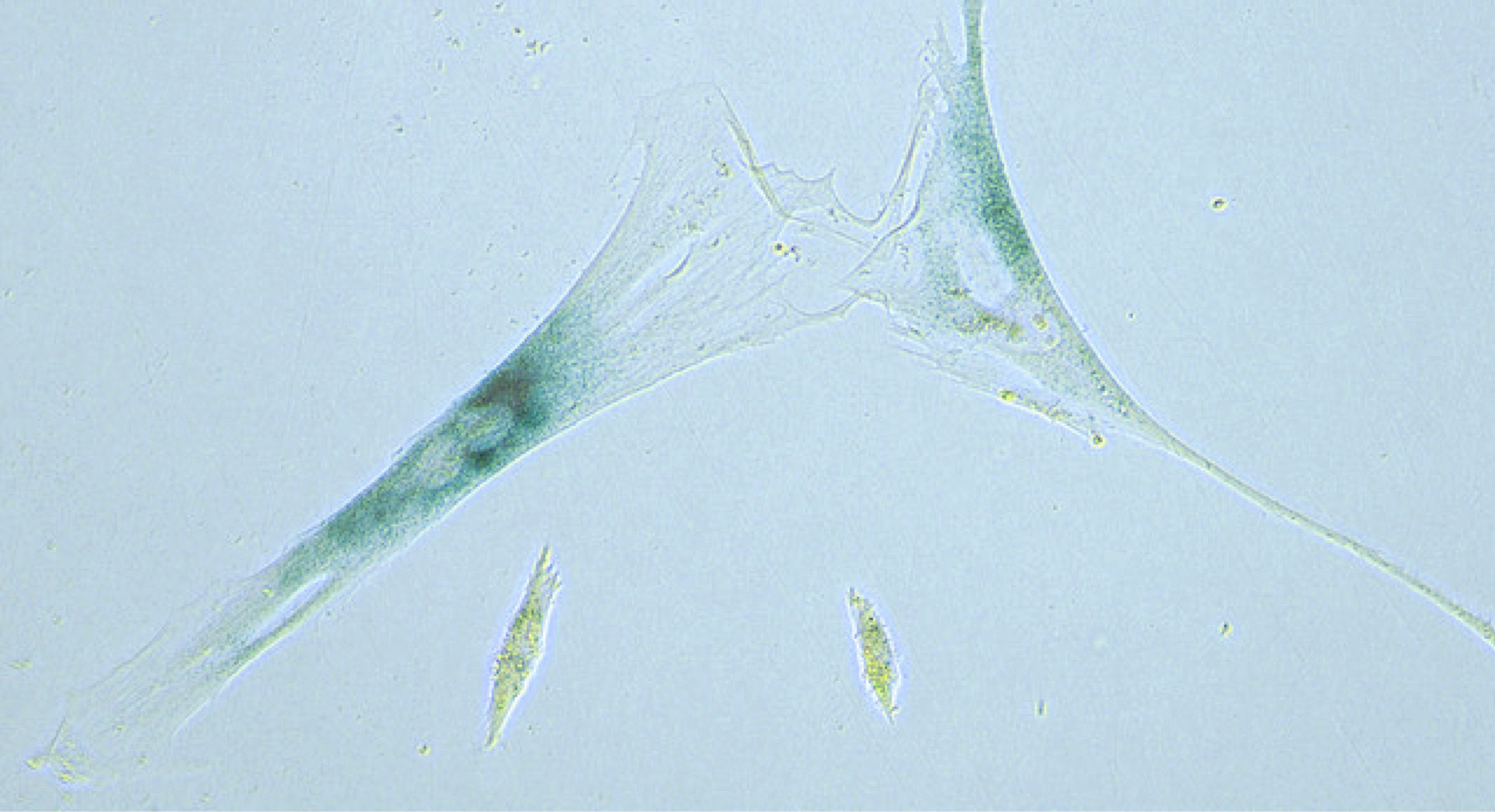 What are Zombie Cells and Are They the Key to Anti-Aging?