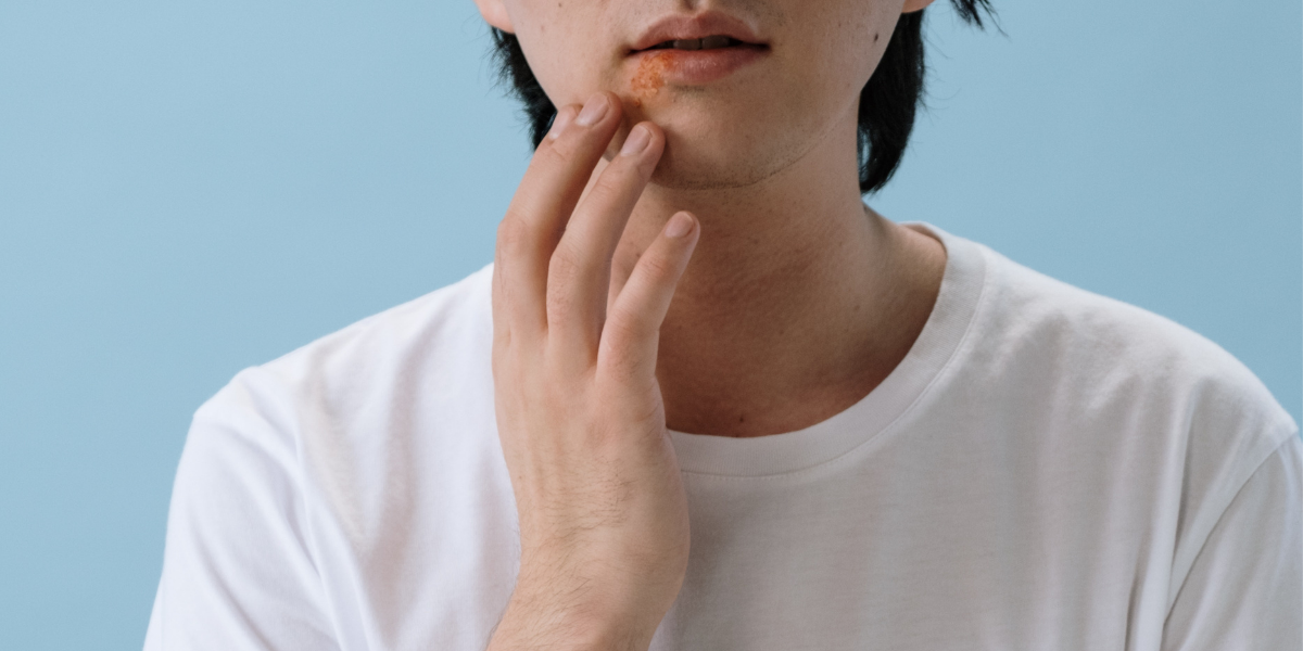 How to Get Rid of a Cold Sore | Steps to Take and What to Know
