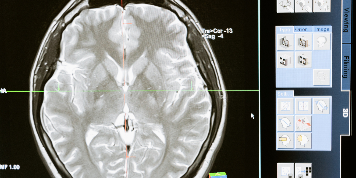 The right brain vs left brain argument - fully explained | Inquirer