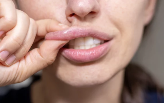 Lip Flip: The Cosmetic Procedure Everyone Is Getting | Inquirer