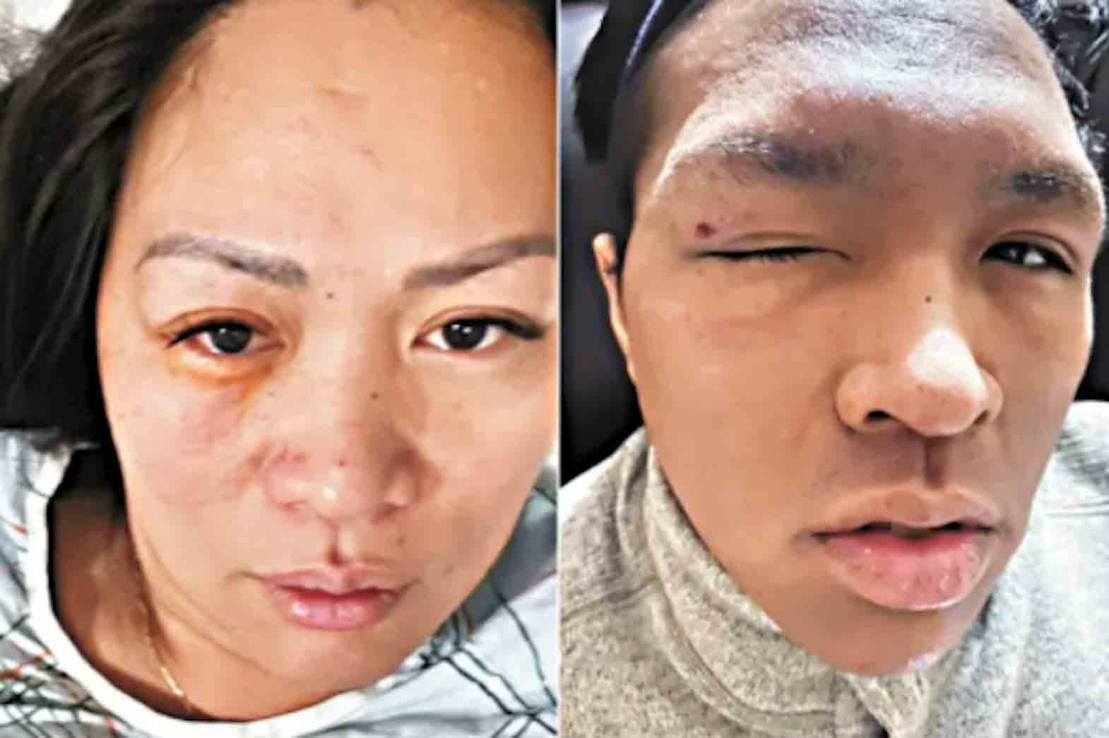 Filipina chef and son seriously hurt in Queens, NY hate attack Filipina ...
