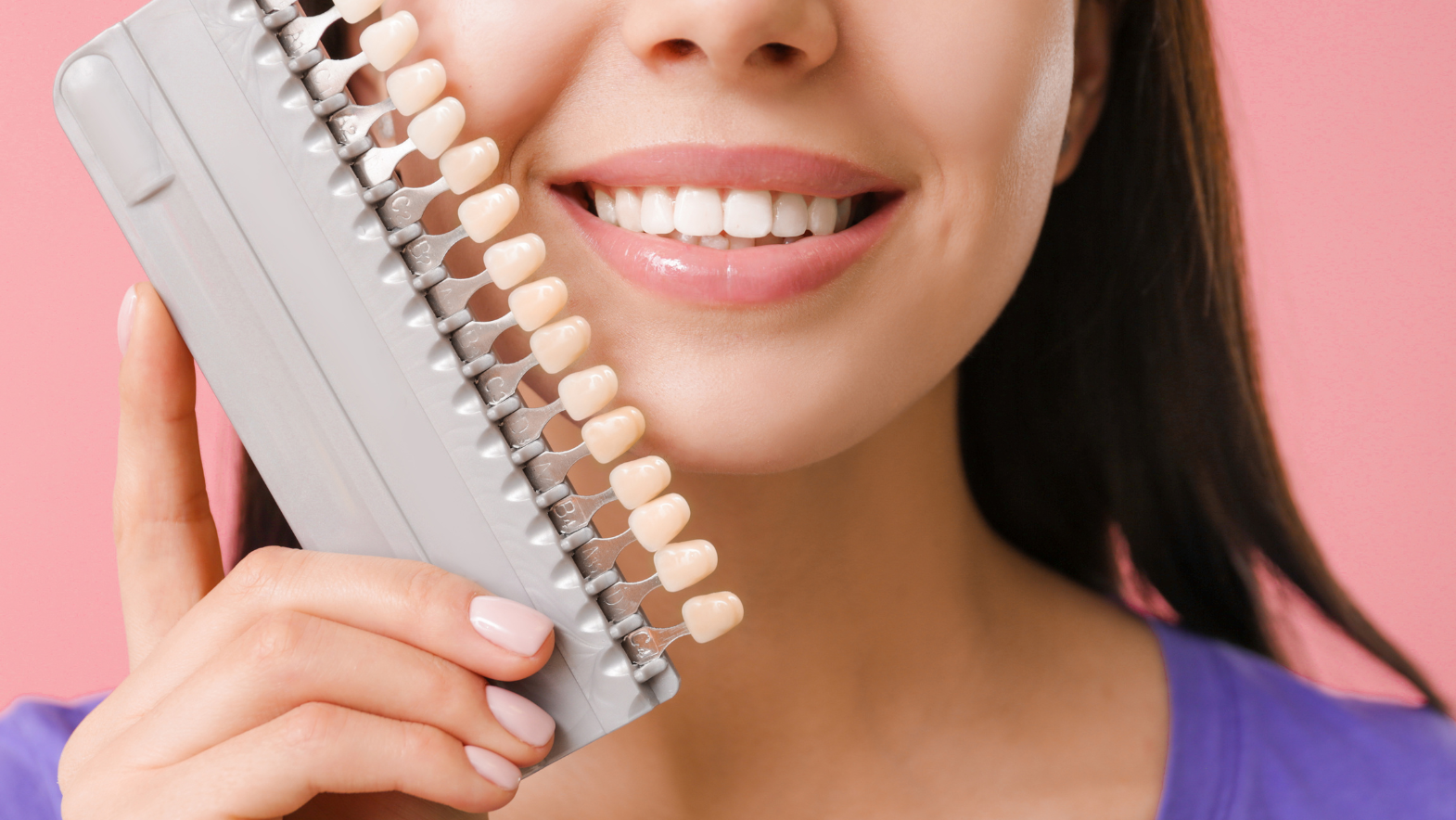Your Guide to the Cost of Veneers: What You Need to Know | Inquirer