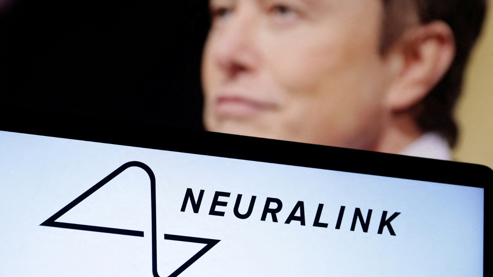 Musk's Neuralink Wins FDA Approval for Brain Implant Research