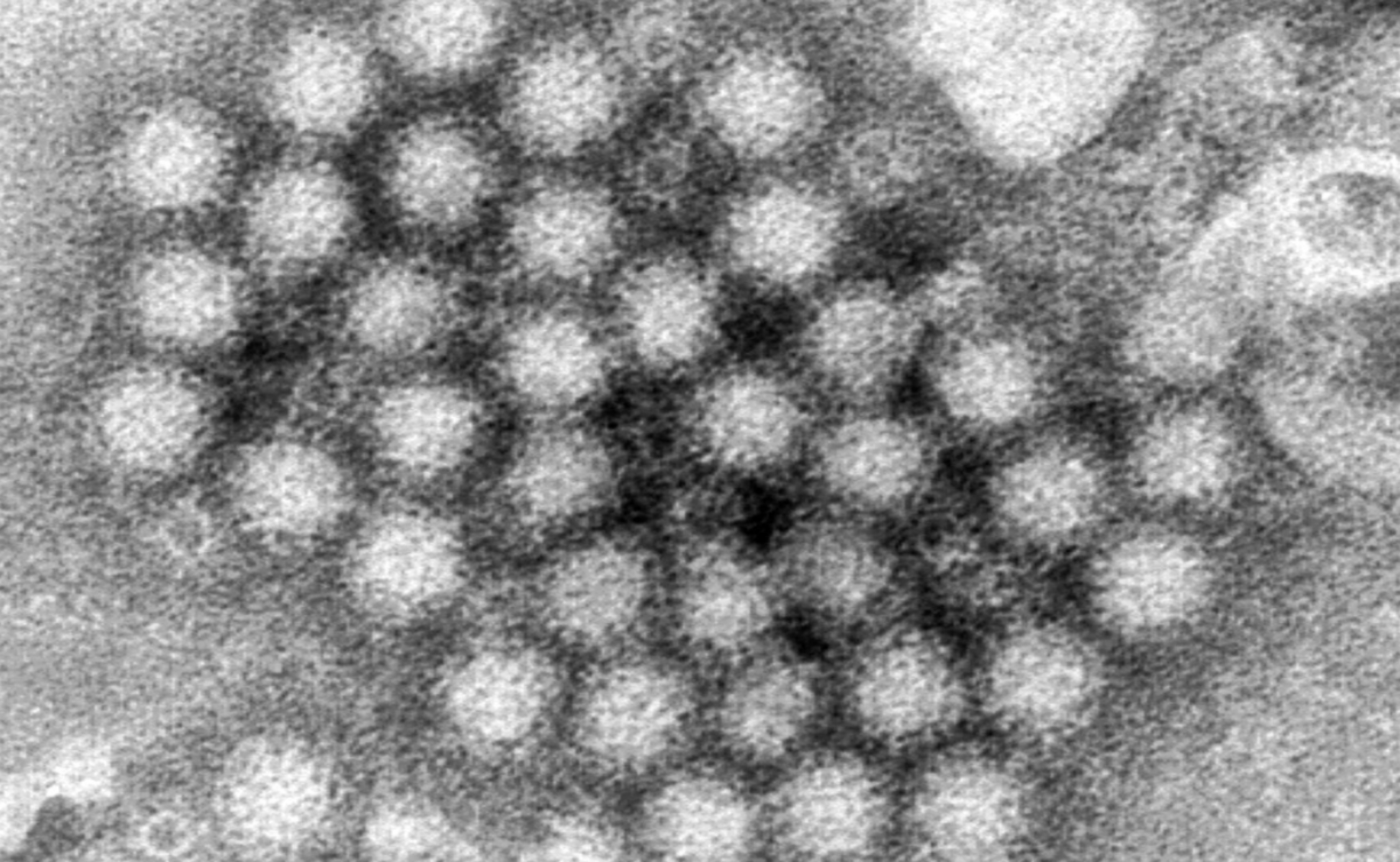 Norovirus outbreak reported at evacuation shelter for LA fire victims